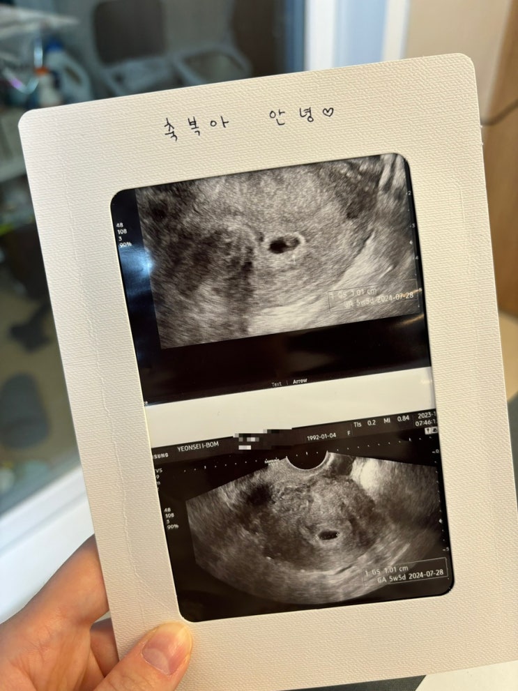축복 로그 시험관 일기 8 아기집난황임신확인서피비침프로기노바질정프롤루텍스 네이버 블로그