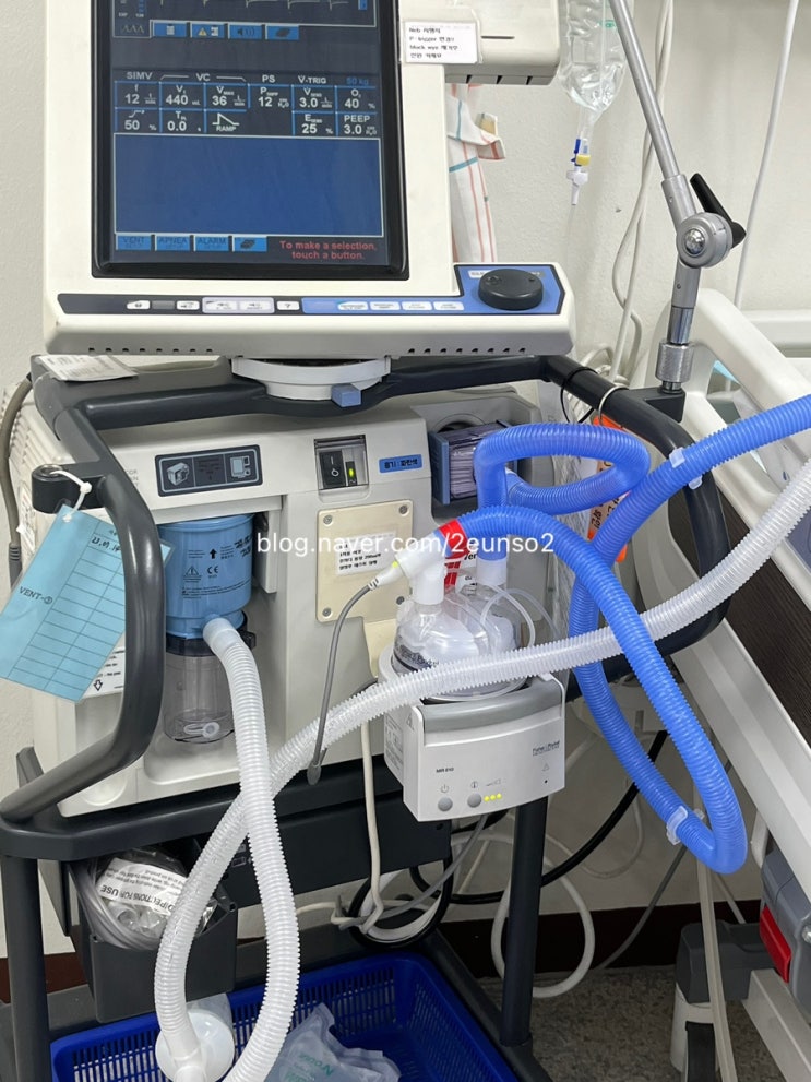 [벤틸레이터 ventilator PB840] SIMV - RR - TV - PEEP -FiO2 기본세팅방법, 간단한 작동방법 ...