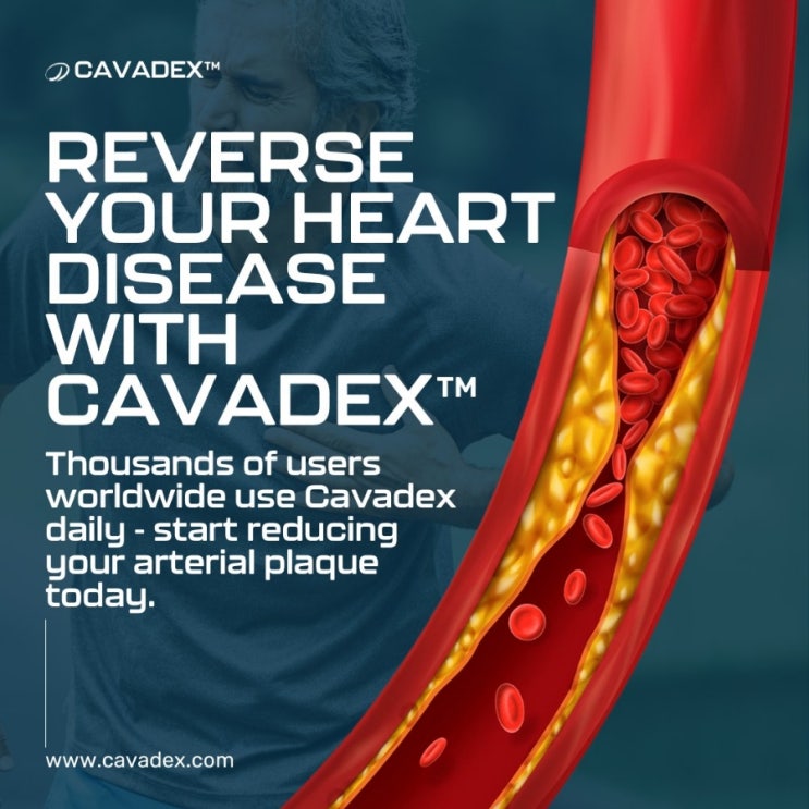 죽상동맥경화증(atherosclerosis)에 대한 일반적인 해독제 및 게임 체인저로서 베타-사이클로덱스트린(Beta ...