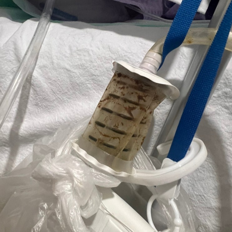 L-tube drain Ace vac 에이스박 k-vac : 네이버 블로그