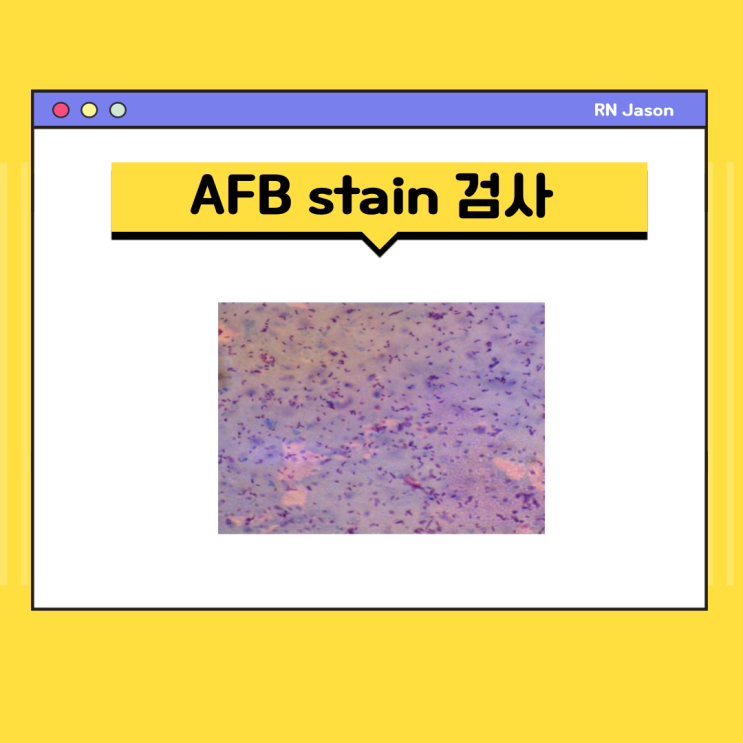 AFB stain 검사 목적, 양성시 치료 방법에 대해서 알아봐요~ : 네이버 블로그