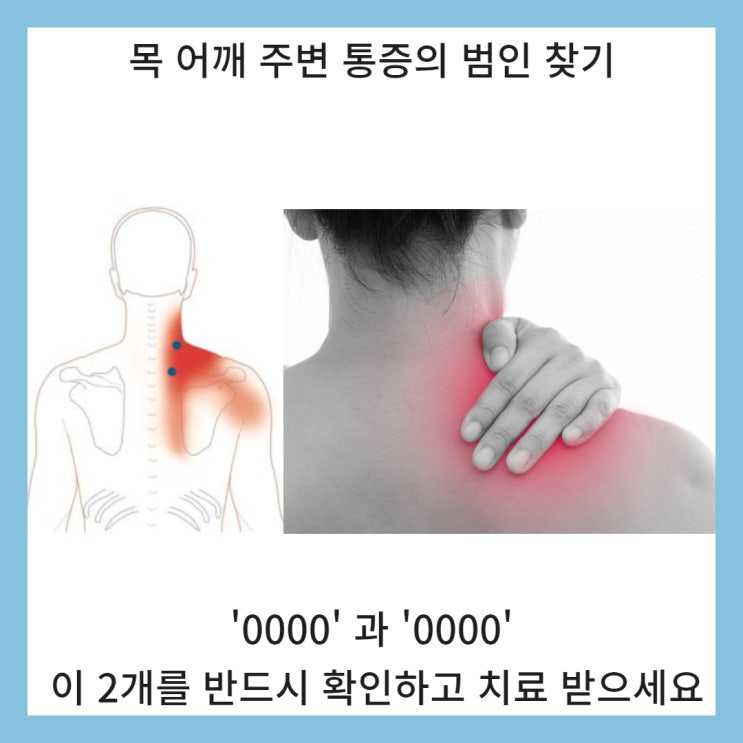 광주 남구 목 어깨 통증 주사 치료 보다 효과적인 추나요법 딱 2가지만 체크하면 실패 안합니다 네이버 블로그