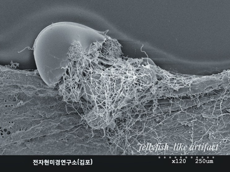 #Aspergillus spp : 네이버 블로그
