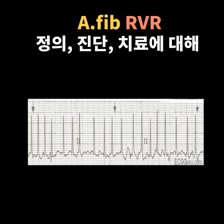A.fib RVR의 원인, 치료, 합병증에 대해서 알아봐요~ : 네이버 블로그