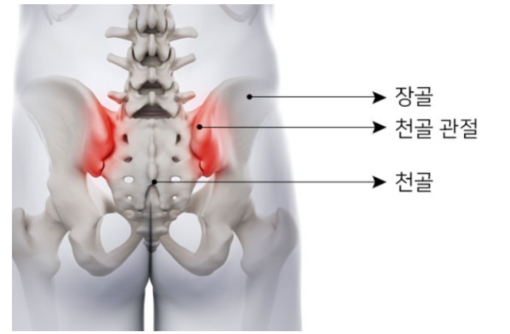 허리통증이 다 허리디스크는 아닙니다 알고가자 천장관절증후군 엉치엉덩관절 증후군 민락동pt의정부pt 휴먼근골격운동센터