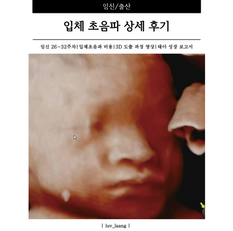 임신 26주 32주 입체 초음파 상세 후기 열달후에 App 네이버 블로그