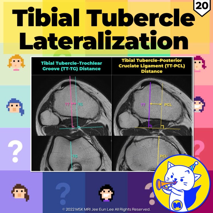 (Fig 4-A.20) Tibial Tubercle Lateralization : 네이버 블로그