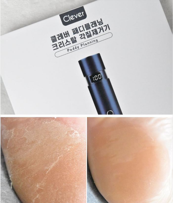 발뒤꿈치각질 제거기 추천 클레버 패디플래닝 크리스탈 각질제거기 네이버 블로그