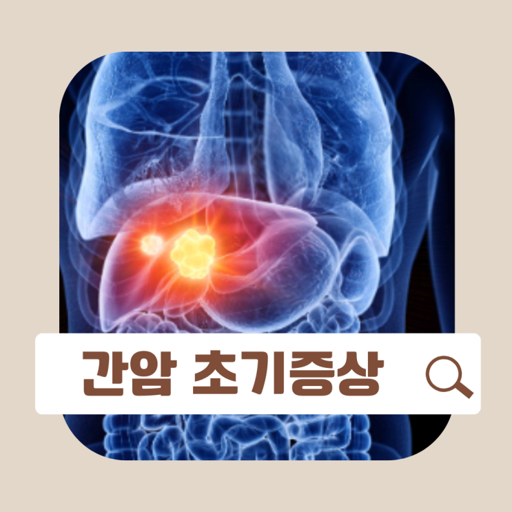 간암 초기증상 1기 2기 3기 4기 진단 원인 네이버 블로그