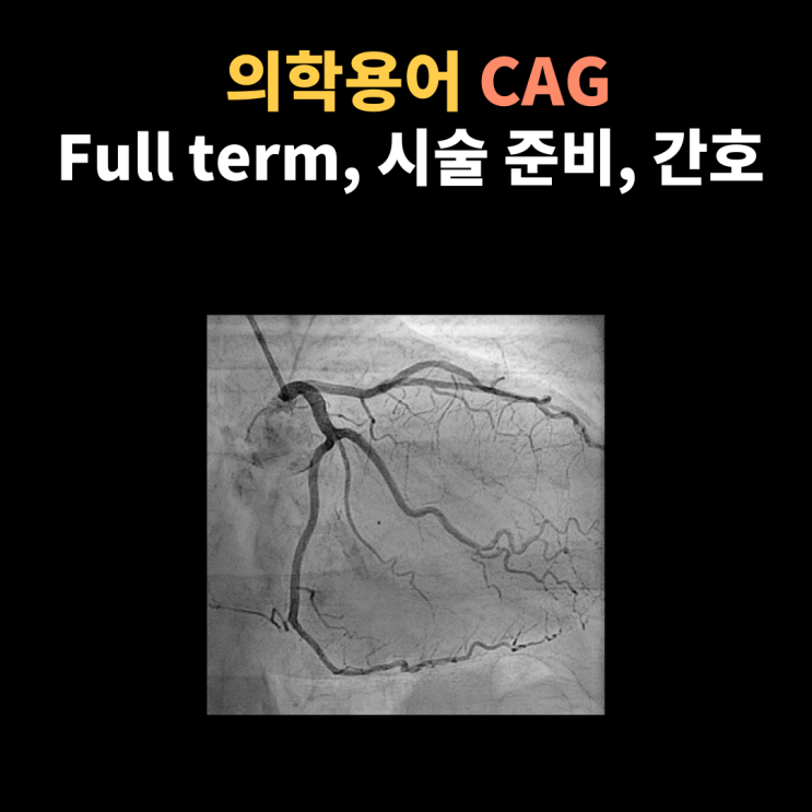 의학용어 CAG, 관상동맥 조영술의 관련 질환과 시술 준비 그리고 시술 후 간호에 대해서 알아봐요~ : 네이버 블로그