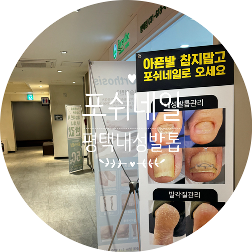 평택내성발톱 평택발톱교정 잘하는 포쉬네일 뉴코아평택점 네이버 블로그