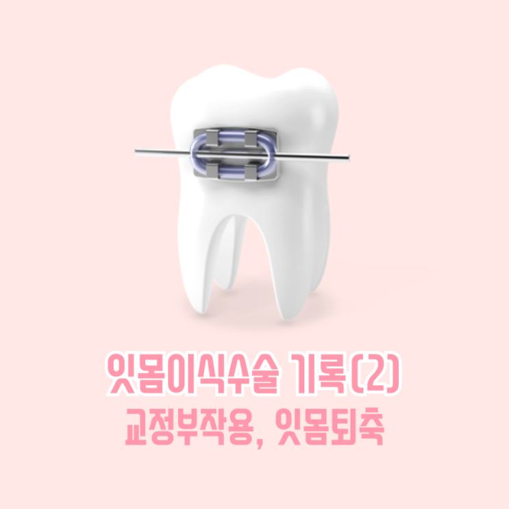미용목적 치아 교정 부작용 잇몸 퇴축으로 인한 잇몸이식수술 기록2 네이버 블로그