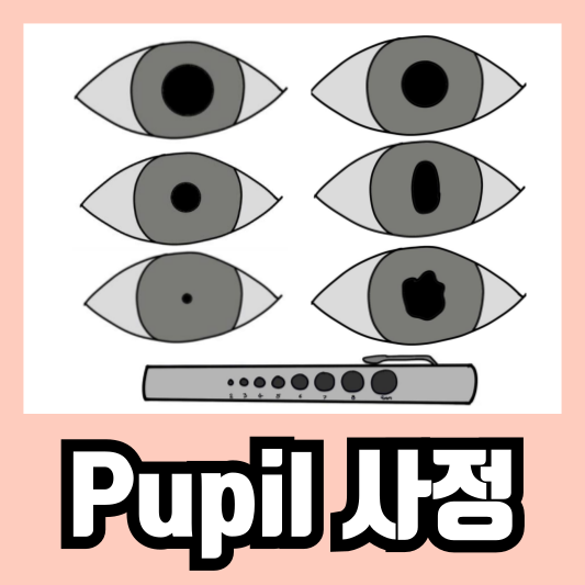 pupil 크기 pupil 모양 pupil light reflex 빛반사 보는 법 : 네이버 블로그