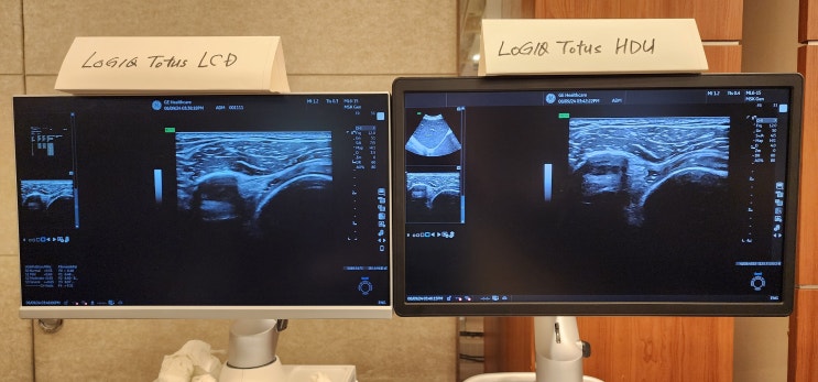 GE 초음파 / 로직 토투스(LOGIQ TOTUS) 출시 : 네이버 블로그