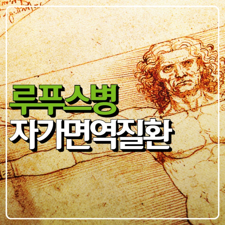 홍반성 루푸스병 루프스병 증상과 원인 임신 자가면역질환 네이버 블로그