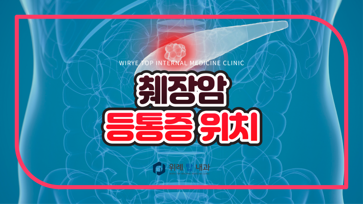 췌장암 등통증 위치 및 다양한 증상 조기 발견 중요 네이버 블로그