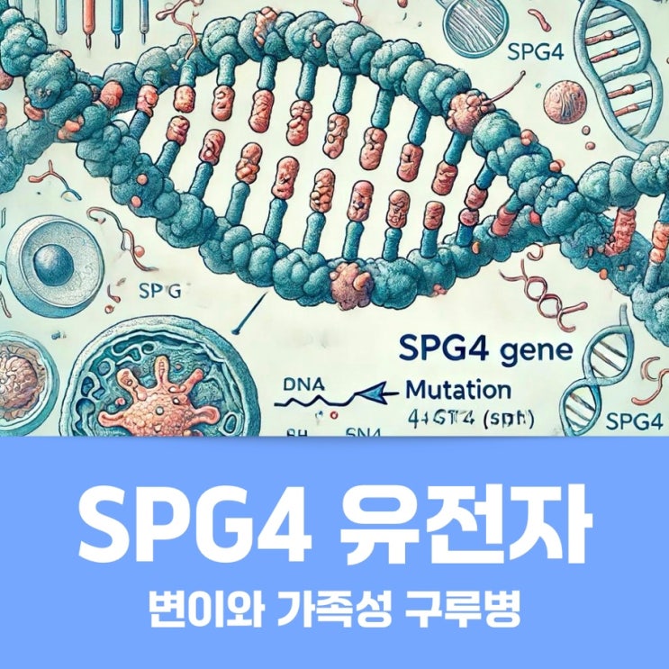 SPG4 유전자 변이와 가족성 구루병(Familial Spastic Paraplegia)의 이해 및 최신 연구 동향 : 네이버 블로그