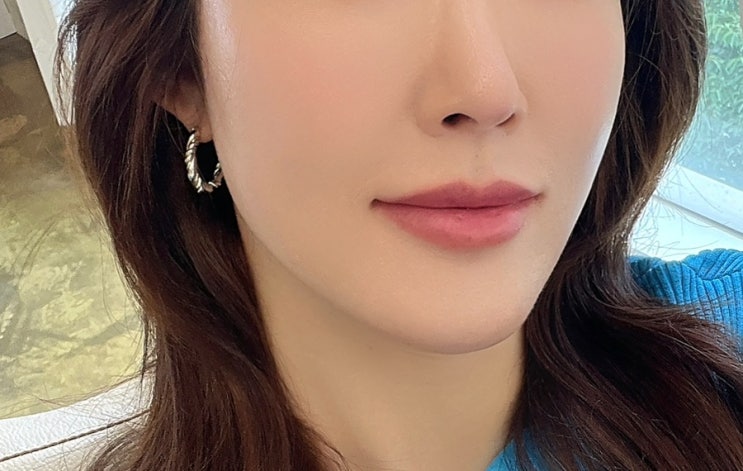 강남 삼성역피부과 인기많은 티타늄리프팅 시술 후기🌷 듀얼티타늄 유지기간 네이버 블로그