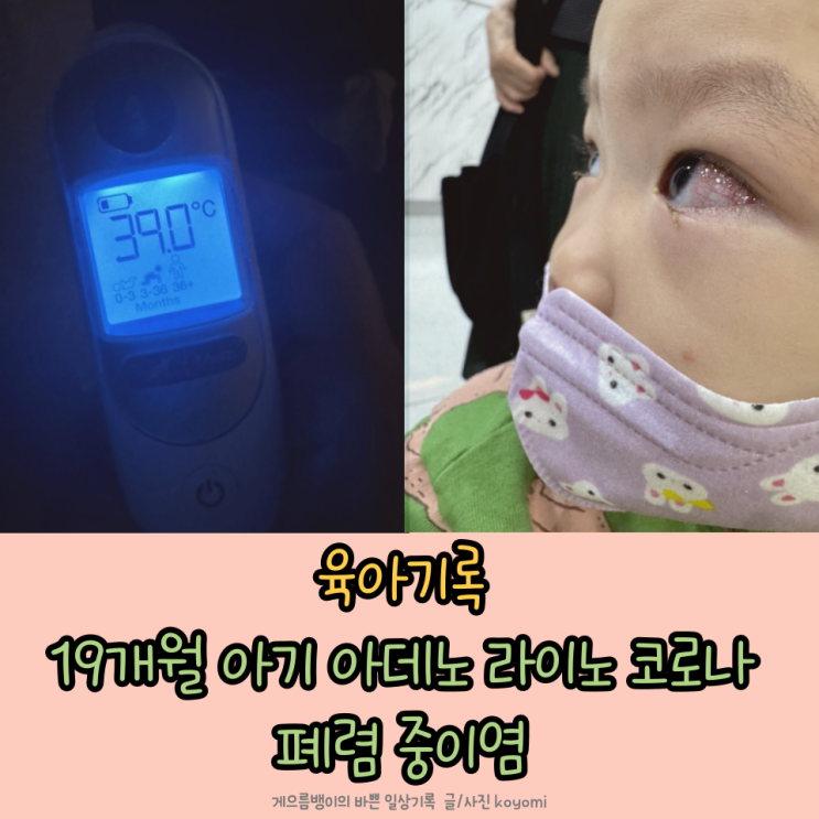 19개월 아기 병원진료기록 아데노 라이노 코로나 헤모인플루엔자 중이염 일주일 입원 일주일 가정보육 네이버 블로그