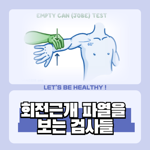 회전근개파열에 대한 검사들 (drop arm test, External rotation lag sign, Dawbarn sign ...