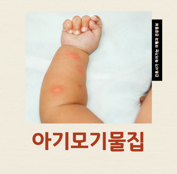 아기모기물집 알레르기 연고 버물리 어떻게 관리해야 할까 네이버 블로그