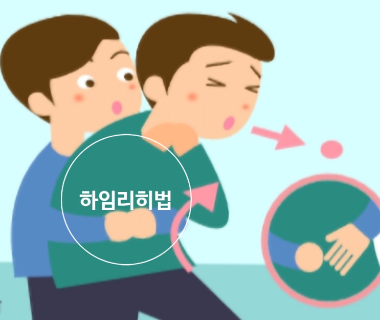 기도폐쇄 기도막혔을때 응급처치 생명을 구하는 하임리히법 네이버 블로그