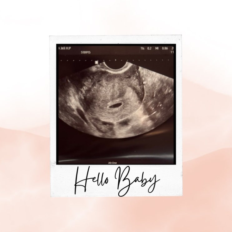 [임신 - 6W3D]설마 이게 입덧...? 애플이 이모들의 서프라이즈/애기 양말/동탄제일 프리미엄 산후조리원 예약 : 네이버 블로그