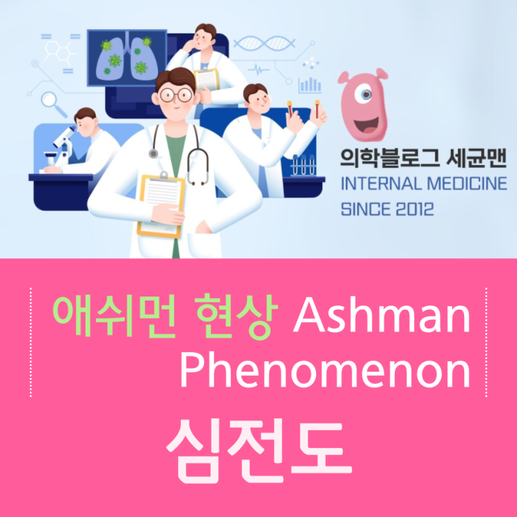애쉬먼 현상 (Ashman Phenomenon) : 심전도 : 네이버 블로그