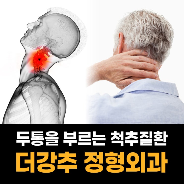 역삼동 정형외과 두통을 부르는 척추질환은 네이버 블로그