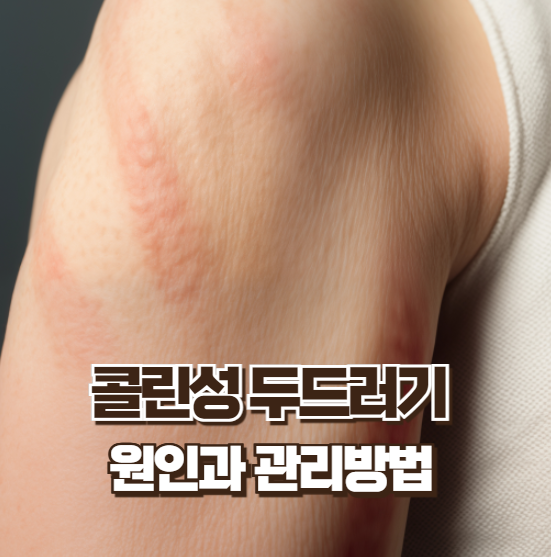 콜린성 두드러기가 생기는 원인과 관리 방법 살롱드비숑울산본점에서 알려드립니다 네이버 블로그