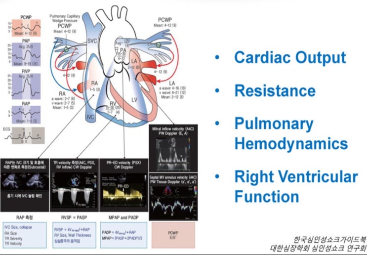 Nclex - CAOD, Angina, MI(myocardial Infarction),HF,Inflammatory Dz of ...