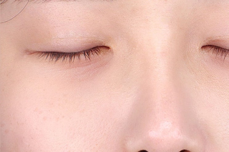 시술 안 부러운 아이크림 추천 : 네이버 블로그