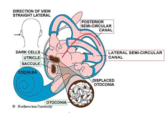 양성 발작성 현기증(BPPV) : 네이버 블로그