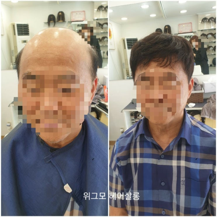 대구 수성구 남자가발 대구가발 위그모 헤어살롱 구김호증모가발 수성점 네이버 블로그