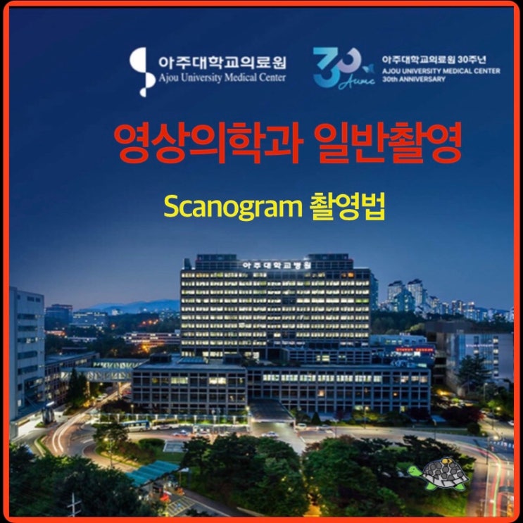 일반촬영 Scanogram 촬영법(다리길이차이 비교) 14번 : 네이버 블로그