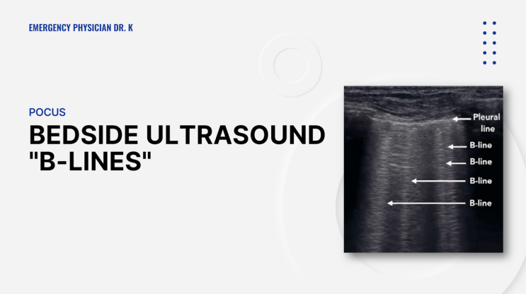 Lung sono B-lines (ft. pulmonary congestion) : 네이버 블로그