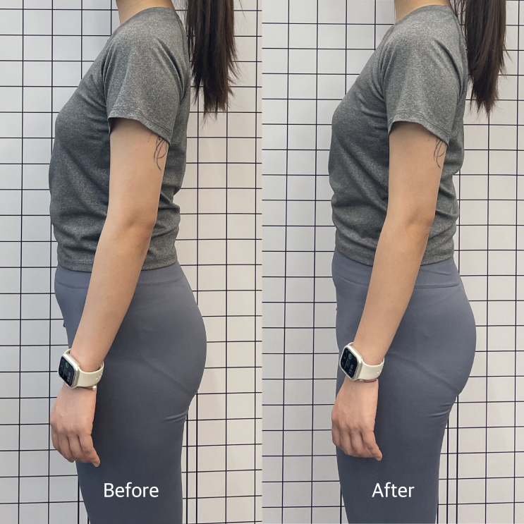 미아사거리pt 미아사거리피티샵 미아사거리필라테스 유포리아 오리엉덩이 교정 필라테스 골반전방경사 복부지방