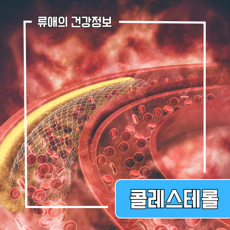 Ldl 콜레스테롤 정상 수치 검사 방법과 Ldl 콜레스테롤 관리 위한 약 정보 네이버 블로그