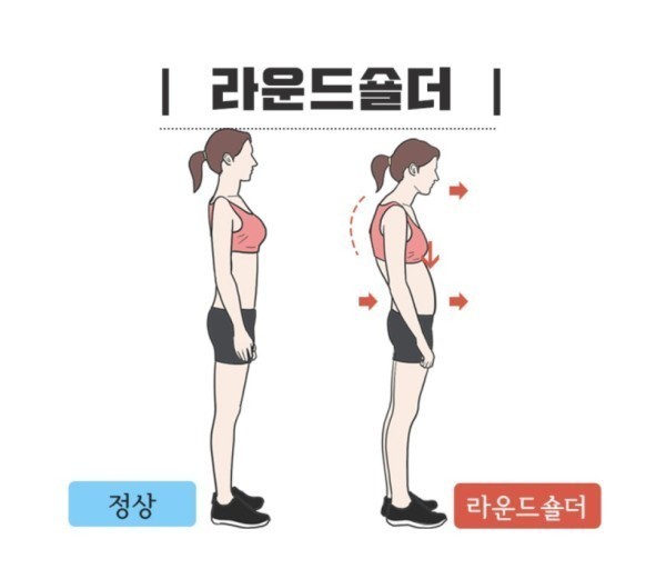 은행동 헬스장 은행동 Pt 은계지구 헬스장 은계지구 Pt 라운드숄더 등 운동이 답일까 No 네이버 블로그