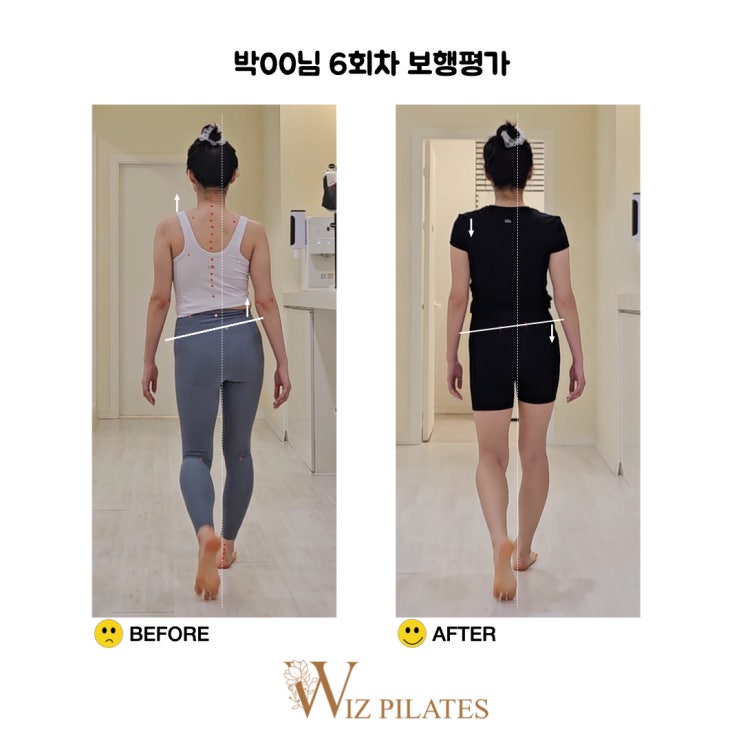 동탄역필라테스 오산동필라테스 체형교정필라테스 위즈필라테스에서 보행분석 받아보세요 네이버 블로그