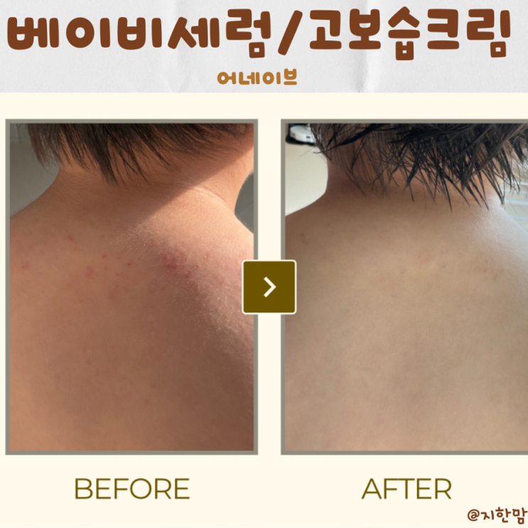 내돈내산 우리 아기 땀띠 걱정 No 어네이브 베이비 세럼and크림세트 네이버 블로그