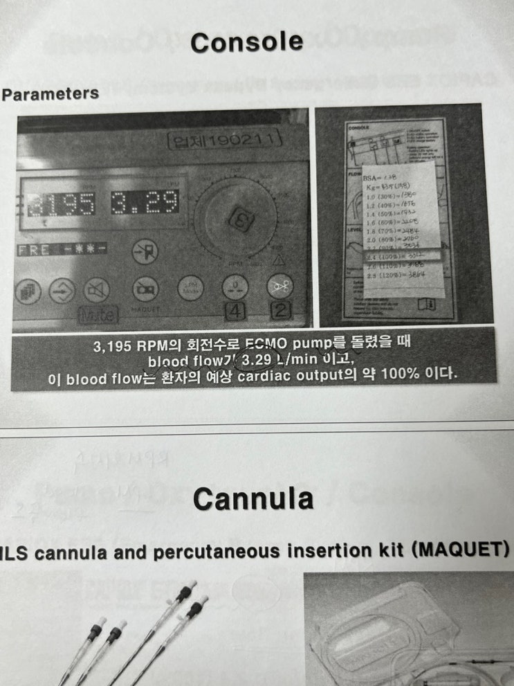 ECMO 적용 및 작동 원리 : 네이버 블로그