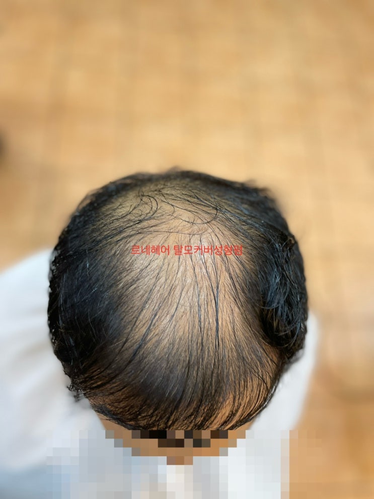 서울에서여기까지 그남자의 탈모헤어변신1부 사상미용부산미용모라하단학장구덕김해화명명지다대남포초량주례