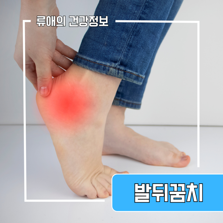 갑자기 걸을때 발뒤꿈치통증 원인 치료 통풍 네이버 블로그