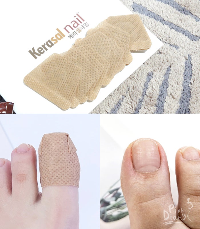 손톱 발톱 영양제 붙이면 끝 케라셀 나이트타임 : 네이버 블로그