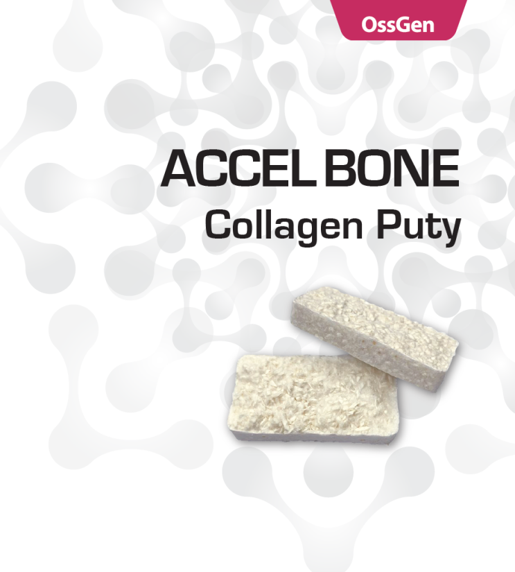 Accel Bone Collagen Putty DBM 생체재료이식용뼈(form type) : 네이버 블로그