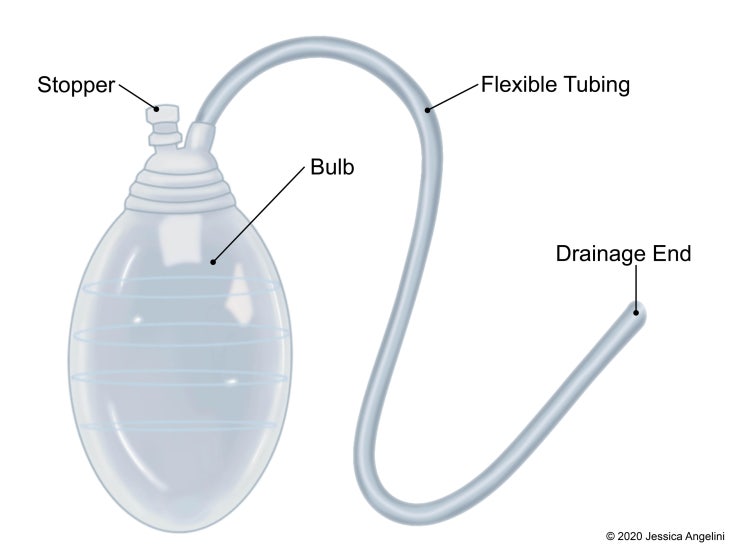 5주 차 스페셜 포토덤프 - 배액관 (Drain) : 네이버 블로그