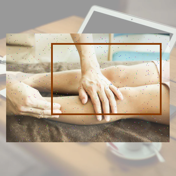 방광암 치료의 획기적인 전환, 엠-벡요법 [M-VAC regimen] : 네이버 블로그