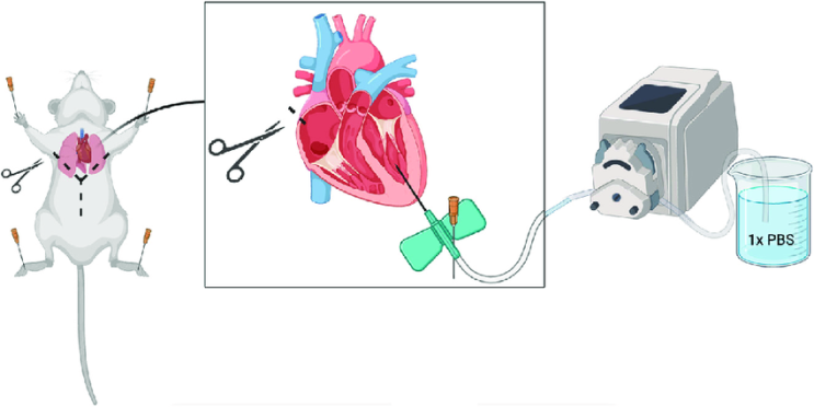 [인턴] Protocol_Transcaridial Perfusion : 네이버 블로그