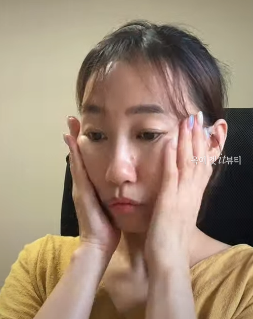 보기 싫은 얼굴 눈가 비립종 원인과 제거 방법 네이버 블로그